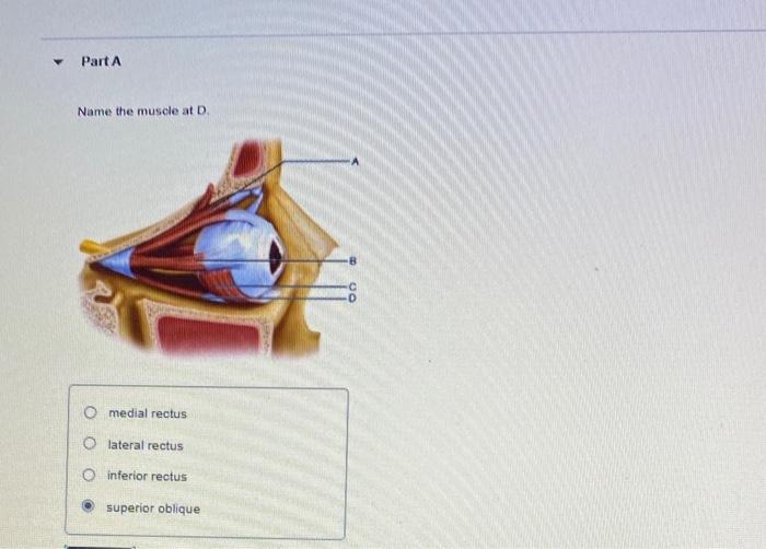 Solved Part A Name the muscle at D O medial rectus lateral | Chegg.com
