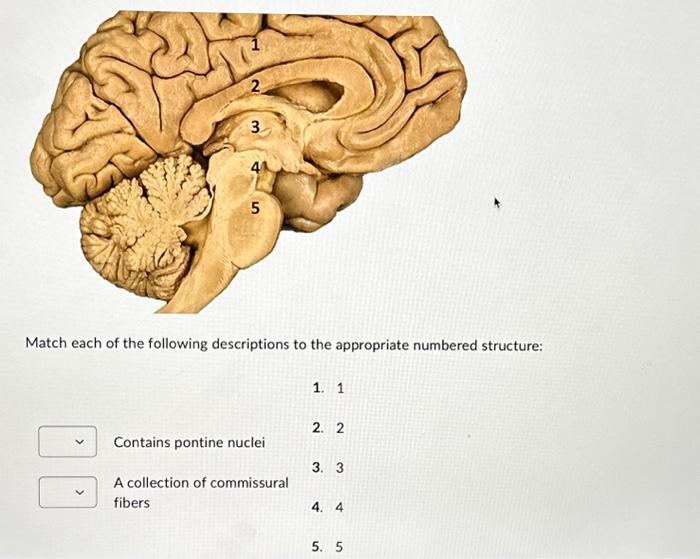 Solved answer fast Match each of the following descriptions | Chegg.com