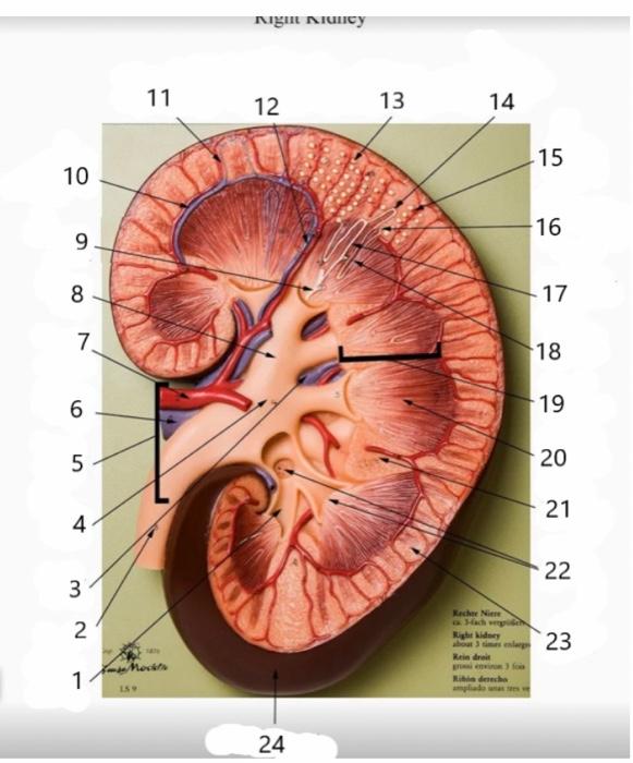 Solved Match the names of the urinary system structures with | Chegg.com