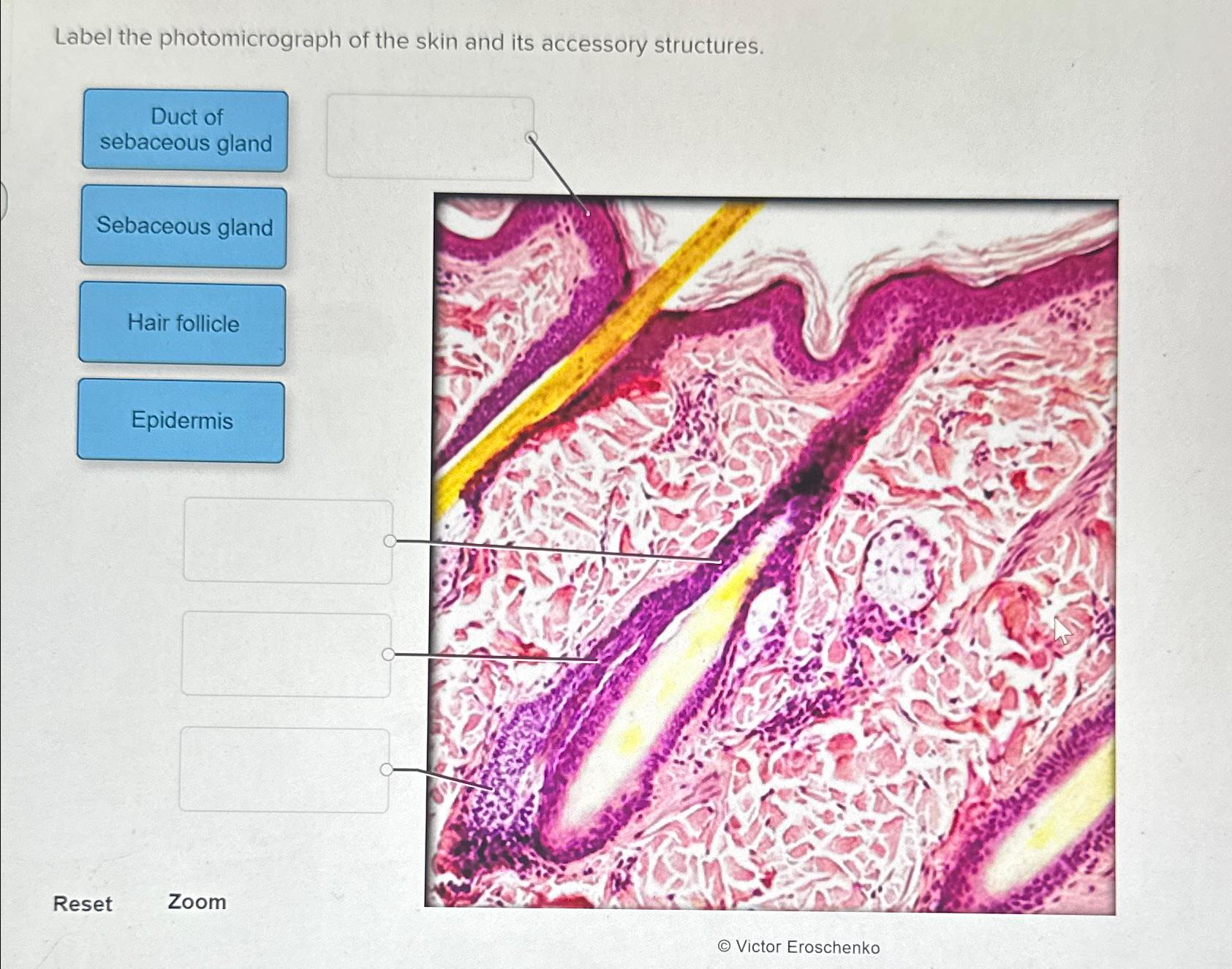 Solved Label the photomicrograph of the skin and its | Chegg.com