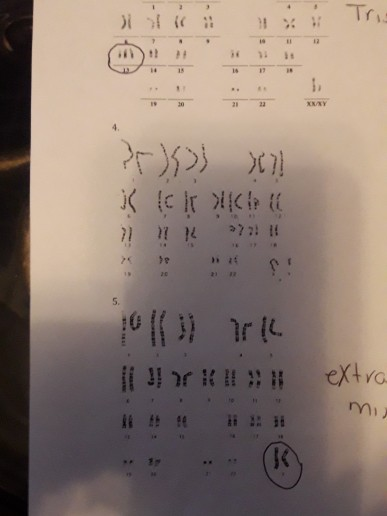 Solved MODULE 2 LAB (Karyotypes) Activity Five karyotypes | Chegg.com