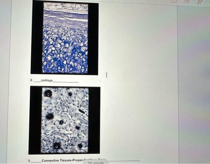 Solved 5. Transitional Epithelium8. cartilage 9. Connective | Chegg.com