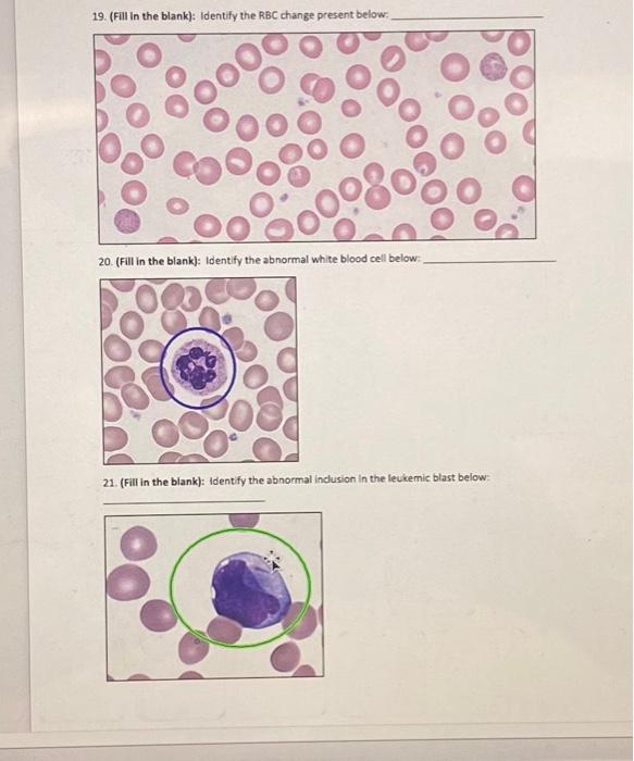 Solved 19. (Fill in the blank): Identify the RBC change | Chegg.com