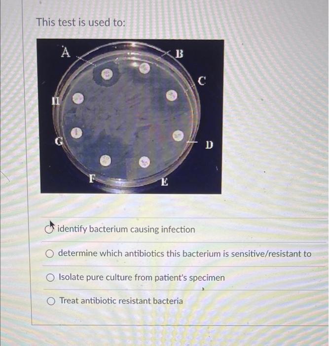 Solved This test is used to: À B C D F E identify bacterium | Chegg.com