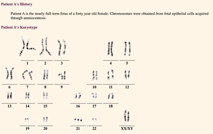 Solved 1. What notations would you use for Patient A's | Chegg.com