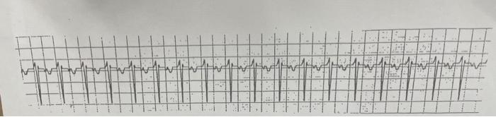Solved What is the final ECG interpretation | Chegg.com