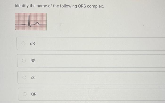 Solved Identify the name of the following QRS complex. qR O | Chegg.com
