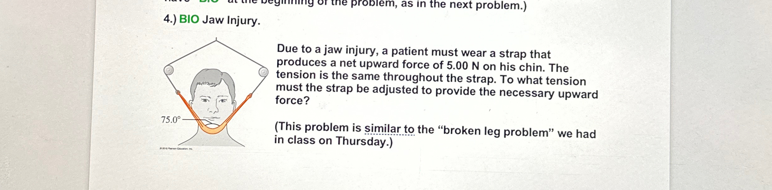 4.) ﻿BIO Jaw Injury.Due to a jaw injury, a patient | Chegg.com