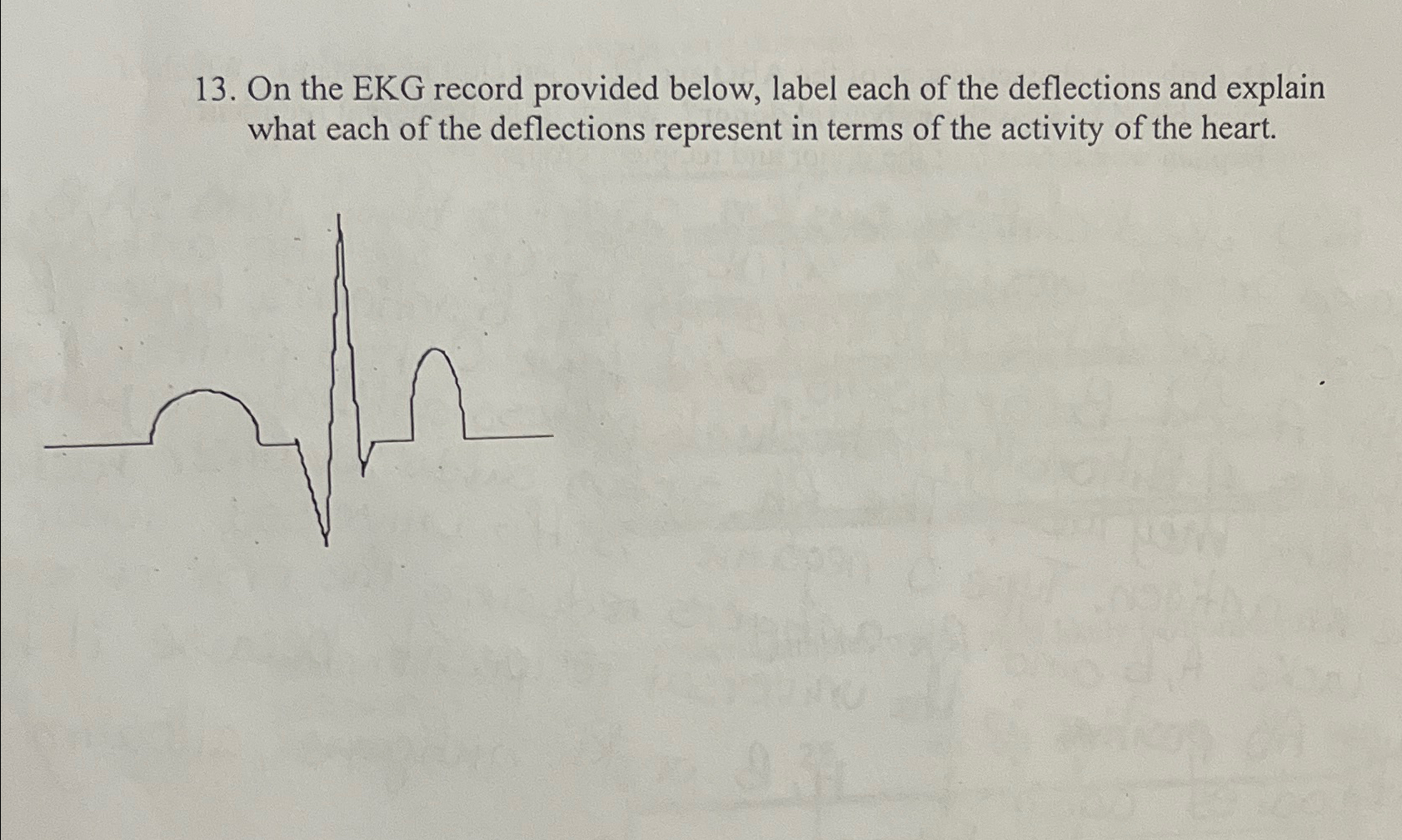 Solved On the EKG record provided below, label each of the | Chegg.com