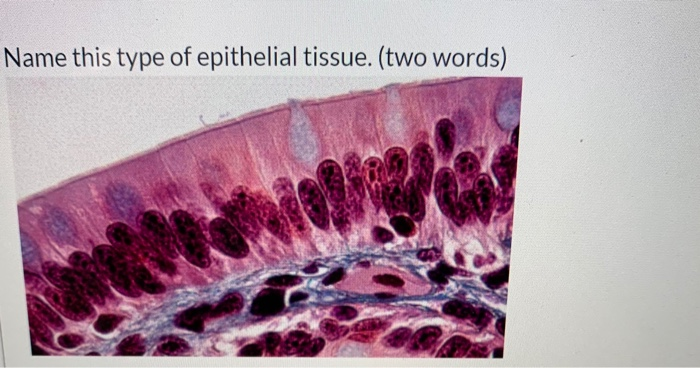 Solved What type of muscle cell does this model represent? | Chegg.com