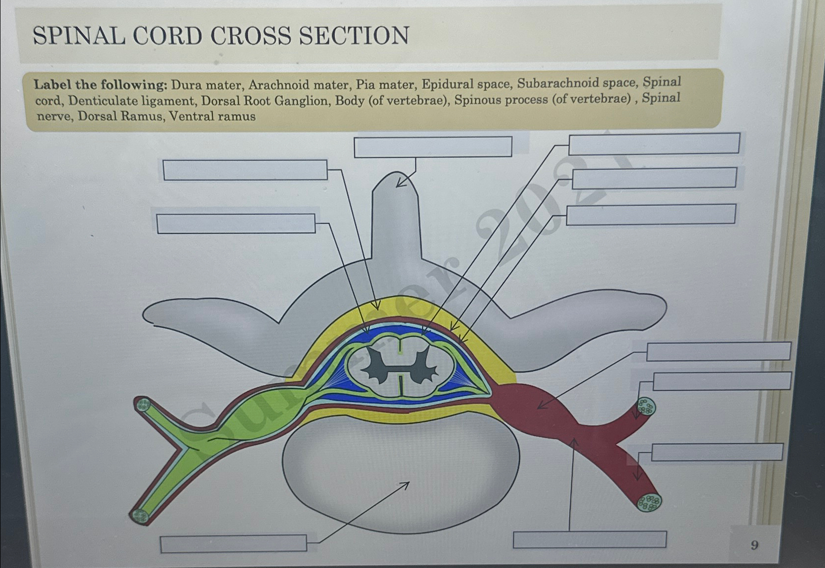 Solved SPINAL CORD CROSS SECTIONLabel the following: Dura | Chegg.com