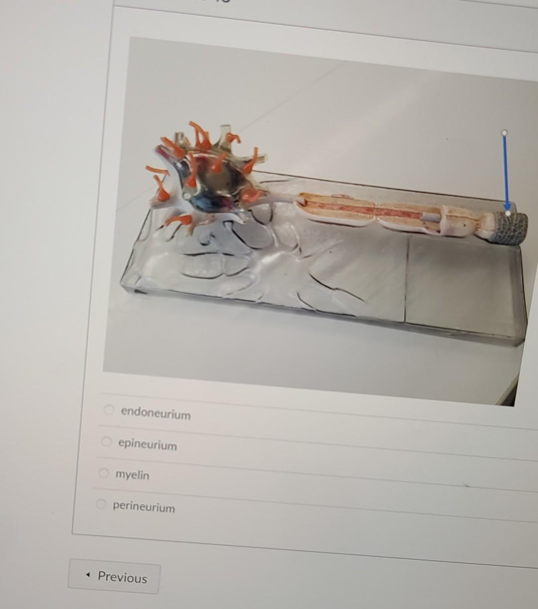 Solved endoneurium epineurium myelin perineurium Previous | Chegg.com