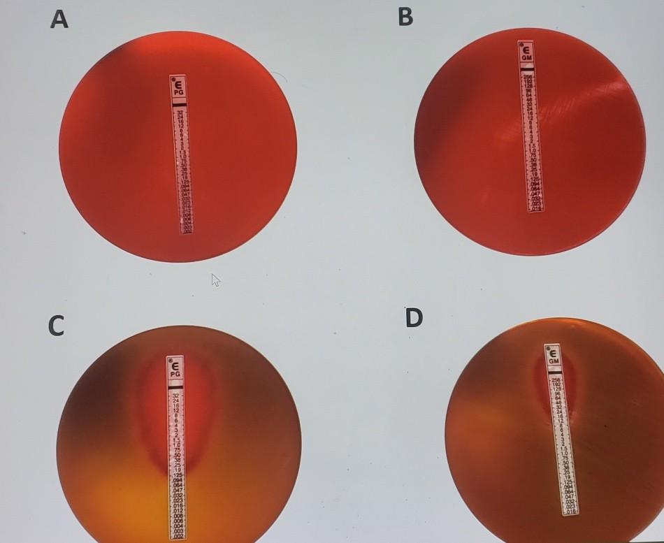 Solved Experiment 1: Single Antibiotic Susceptibility E-Test | Chegg.com