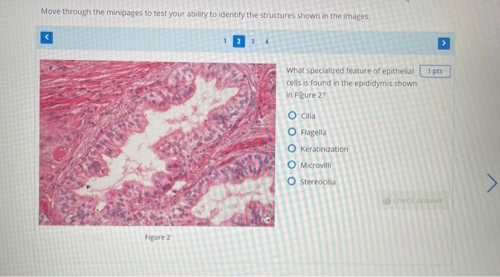 Solved Move through the minipages to test your ability to | Chegg.com