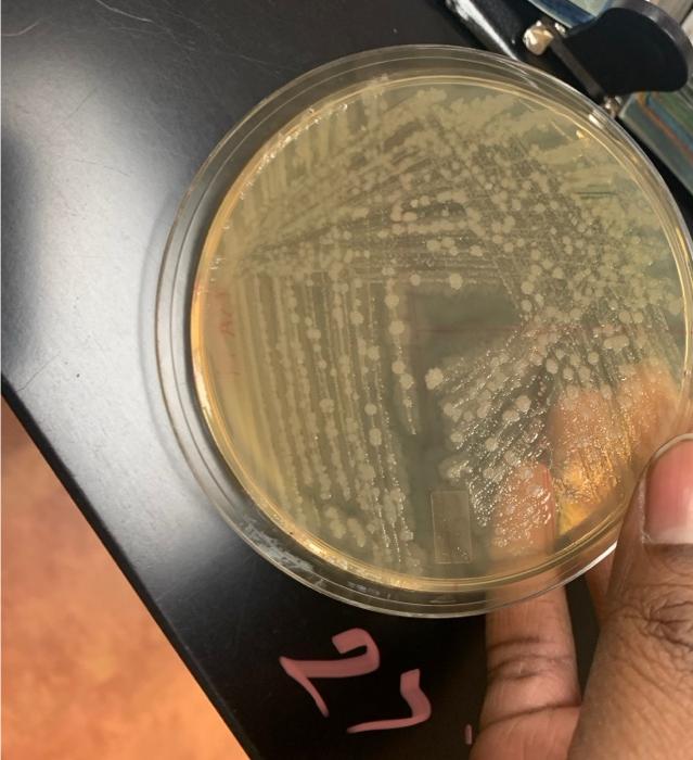 Solved i have trouble identifying the two types of growth | Chegg.com