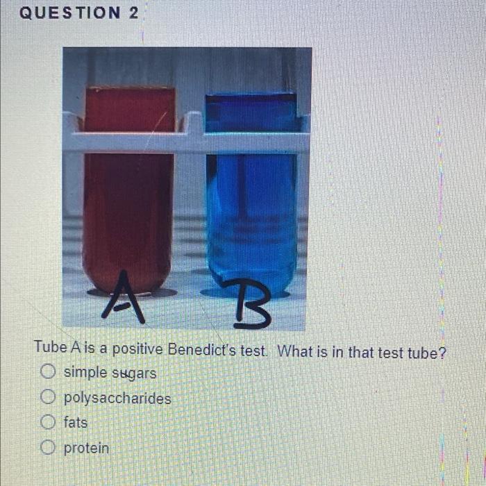 Solved QUESTION 2 B Tube A is a positive Benedict's test. | Chegg.com