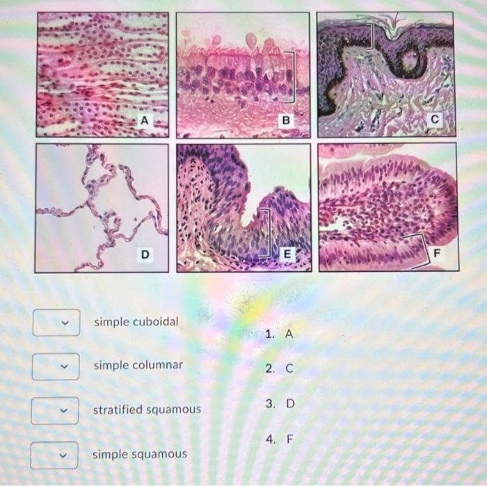 Solved simple cuboidal simple columnar stratified squamous | Chegg.com