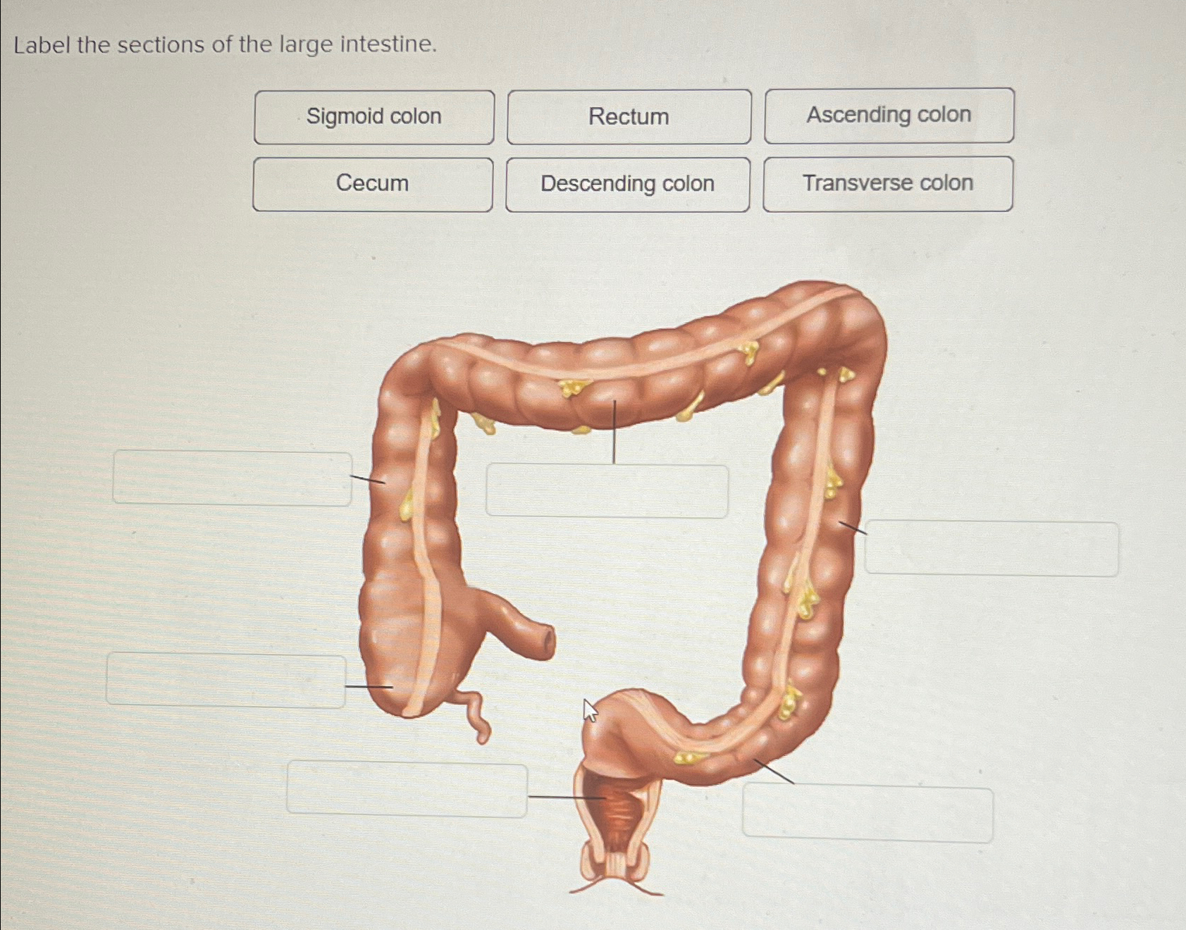 Solved Label the sections of the large intestine. | Chegg.com