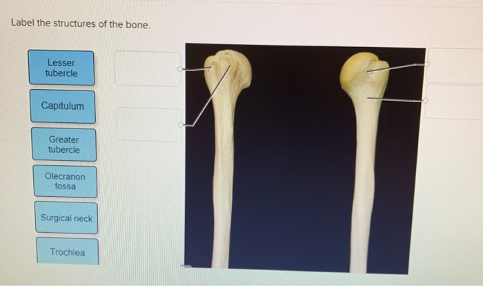 Solved Label the structures of the bone. Lesser tubercle | Chegg.com