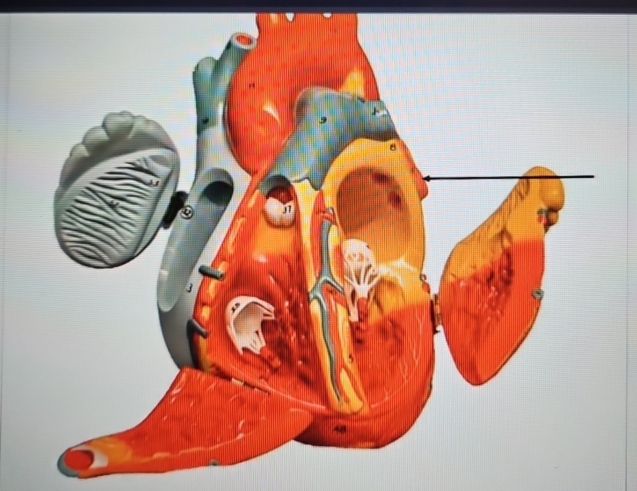 Solved what is the arrow pointing to | Chegg.com