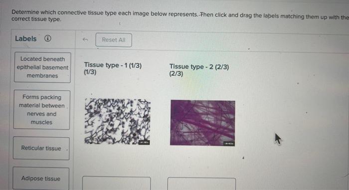 Solved Determine which connective tissue type each image | Chegg.com