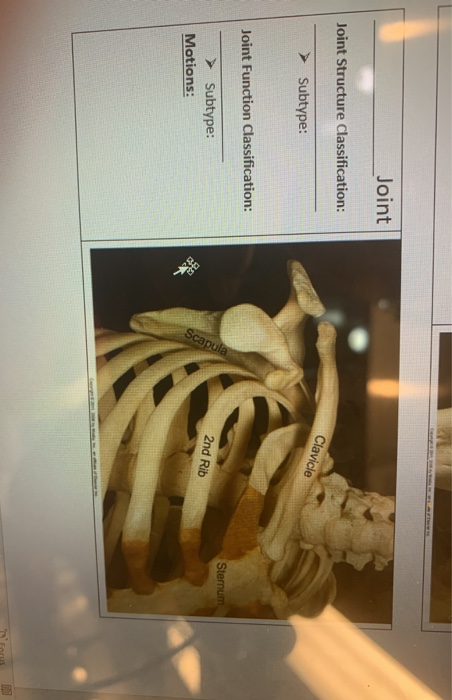 Solved Joint Joint Structure Classification: Clavicle | Chegg.com