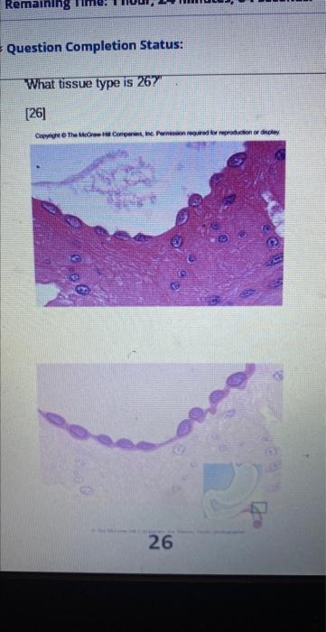 Solved Question Completion Status: What tissue type is 26′′ | Chegg.com