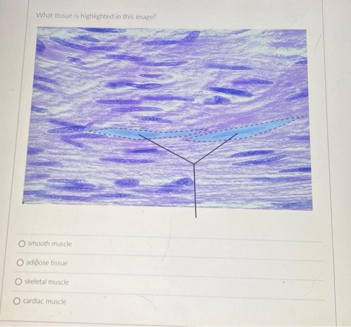 Solved What tissue is highlighted in this imaze? smooth | Chegg.com