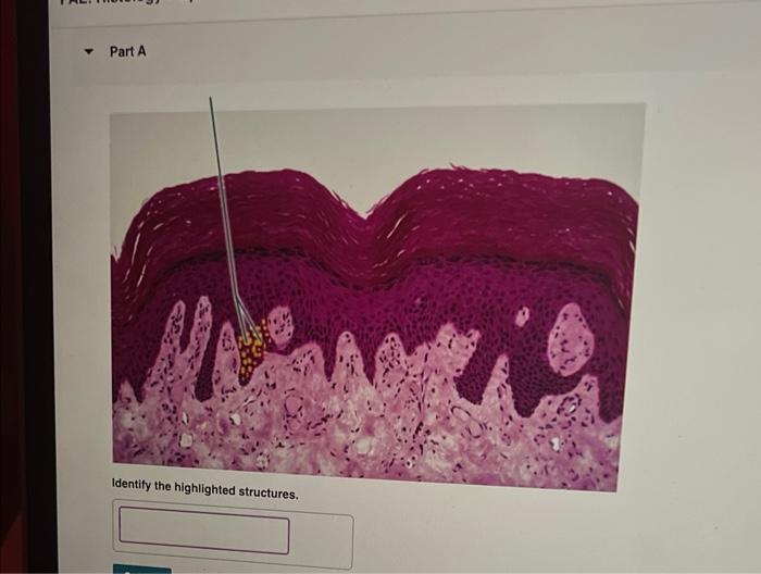 Solved Idenury the highlighted fiber type. Identify the | Chegg.com