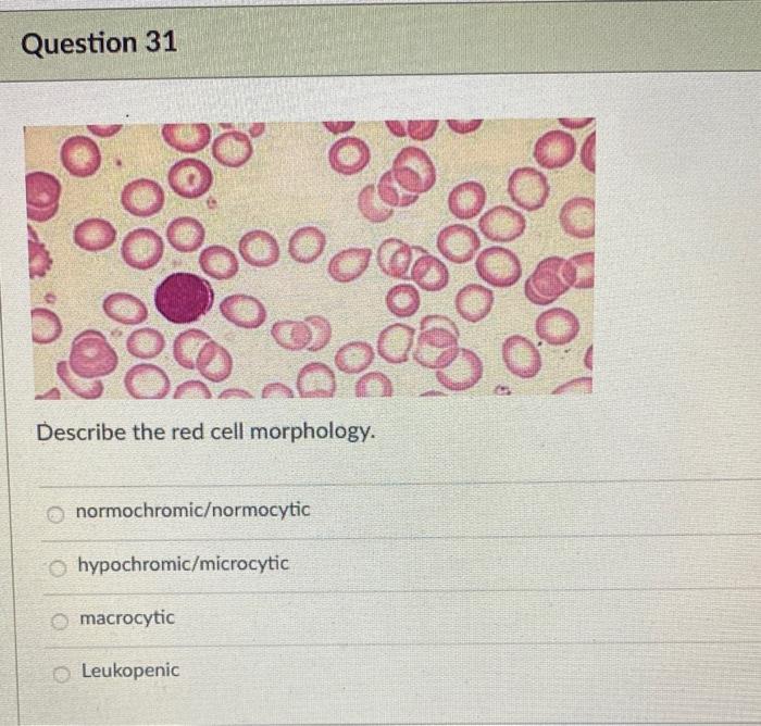 Solved Question 31 or Describe the red cell morphology. | Chegg.com