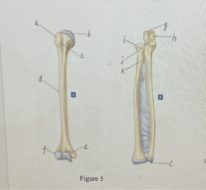 Solved a g -6 c 2 - Figure 5 Capitulum Greater tubercle | Chegg.com
