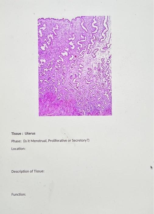 Solved Tissue : Uterus Phase: (is it Menstrual, | Chegg.com