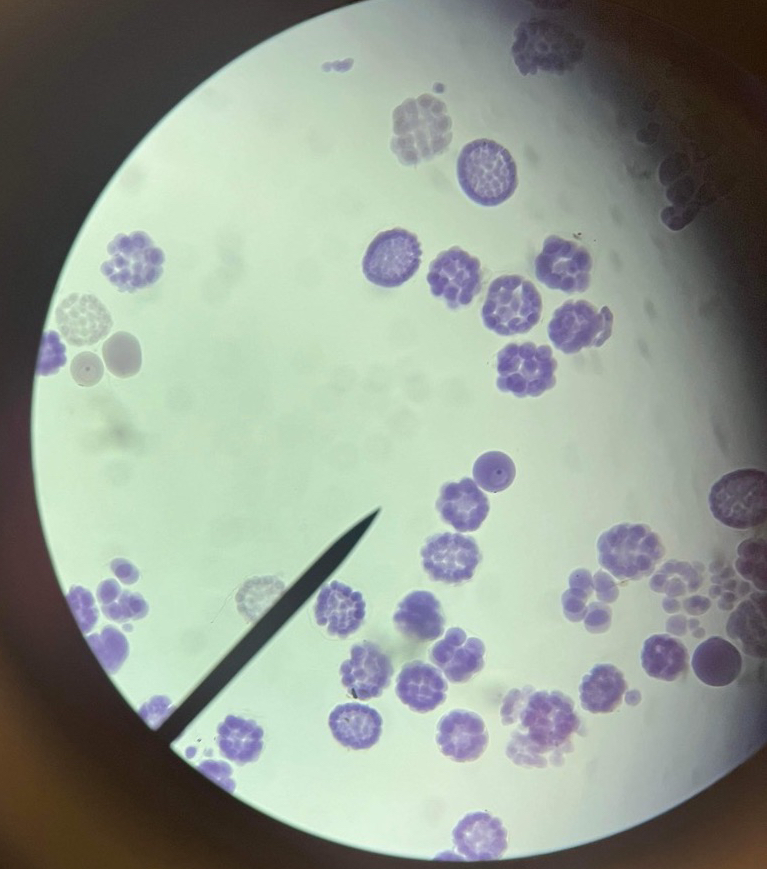 Solved Is this: early cleavage, late cleavage, or starfish | Chegg.com