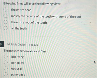 Solved Bite-wing films will give the following view:the | Chegg.com