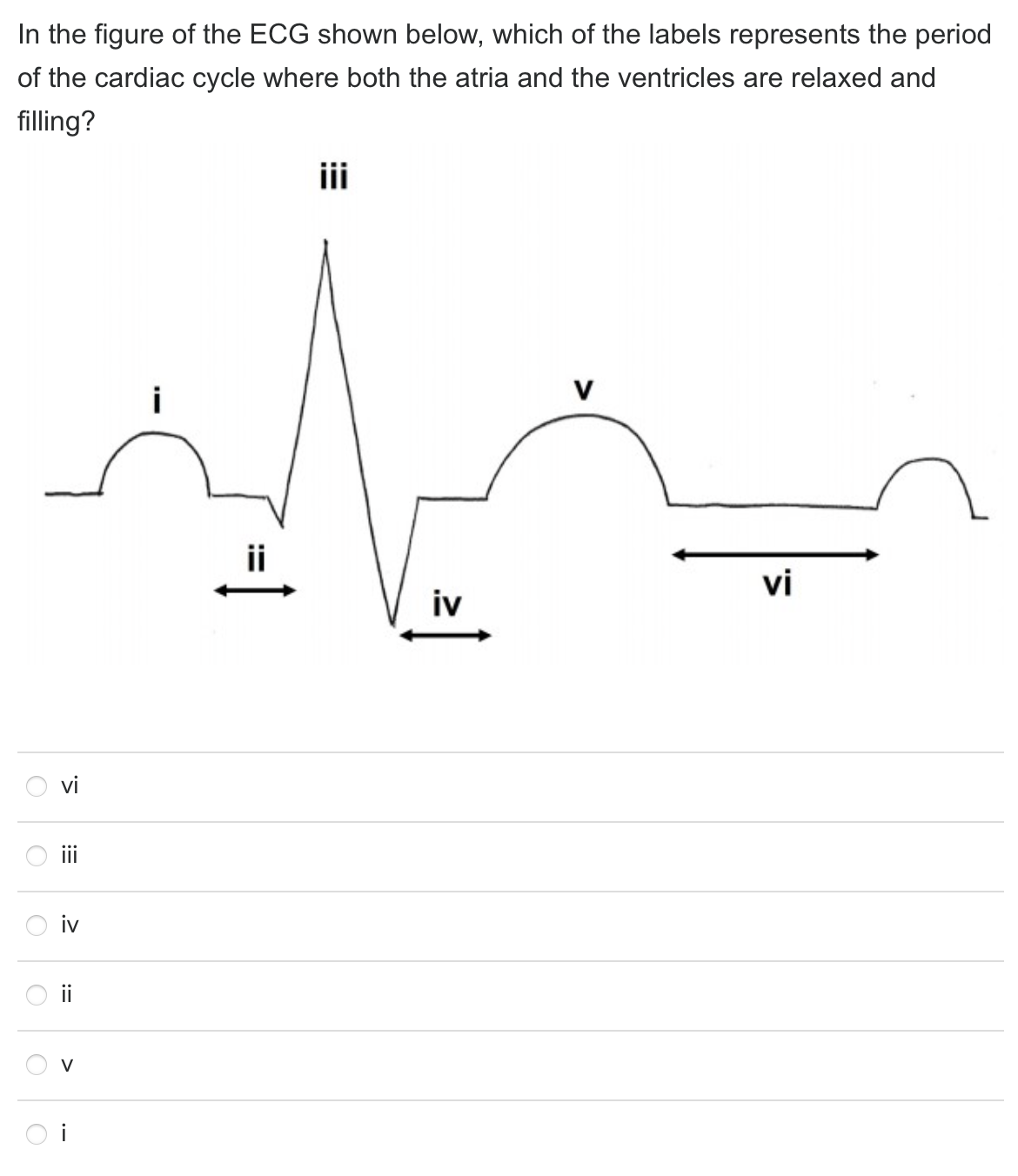 Solved In the figure of the ECG shown below, which of the | Chegg.com