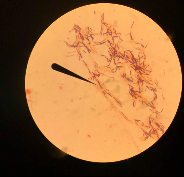 Solved Negative Staining Technique Your Results and | Chegg.com