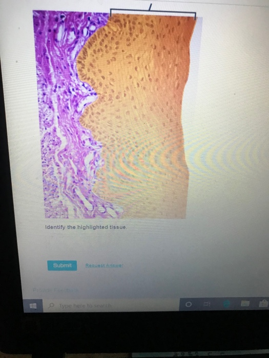 Solved Identify the highlighted tissue Submit Request Answer | Chegg.com