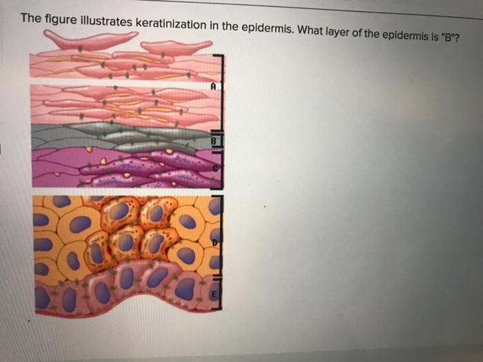 Solved The figure illustrates keratinization in the | Chegg.com