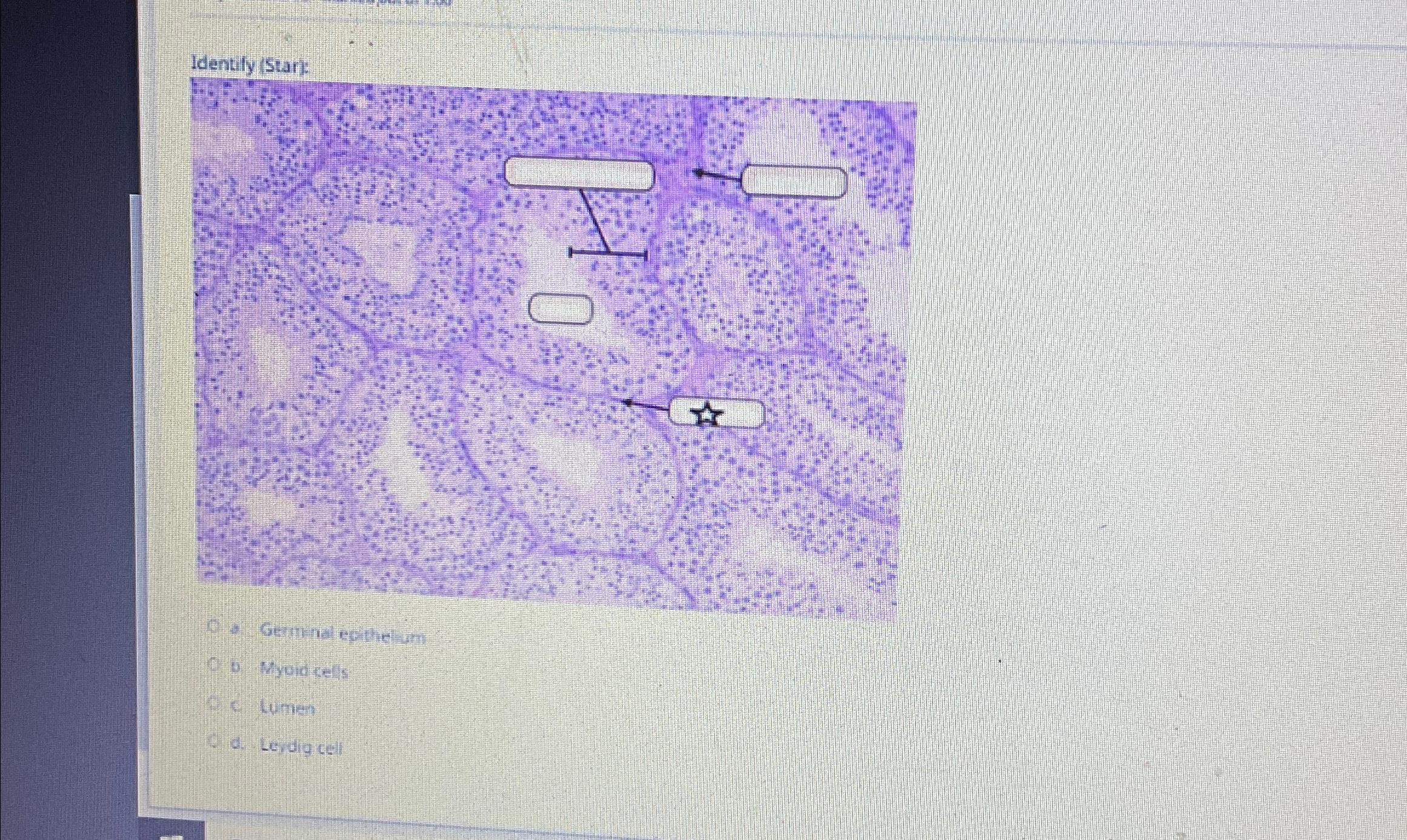 Solved Identily (Sur):3Germinal epithilium 6. ﻿Myoid celsS. | Chegg.com