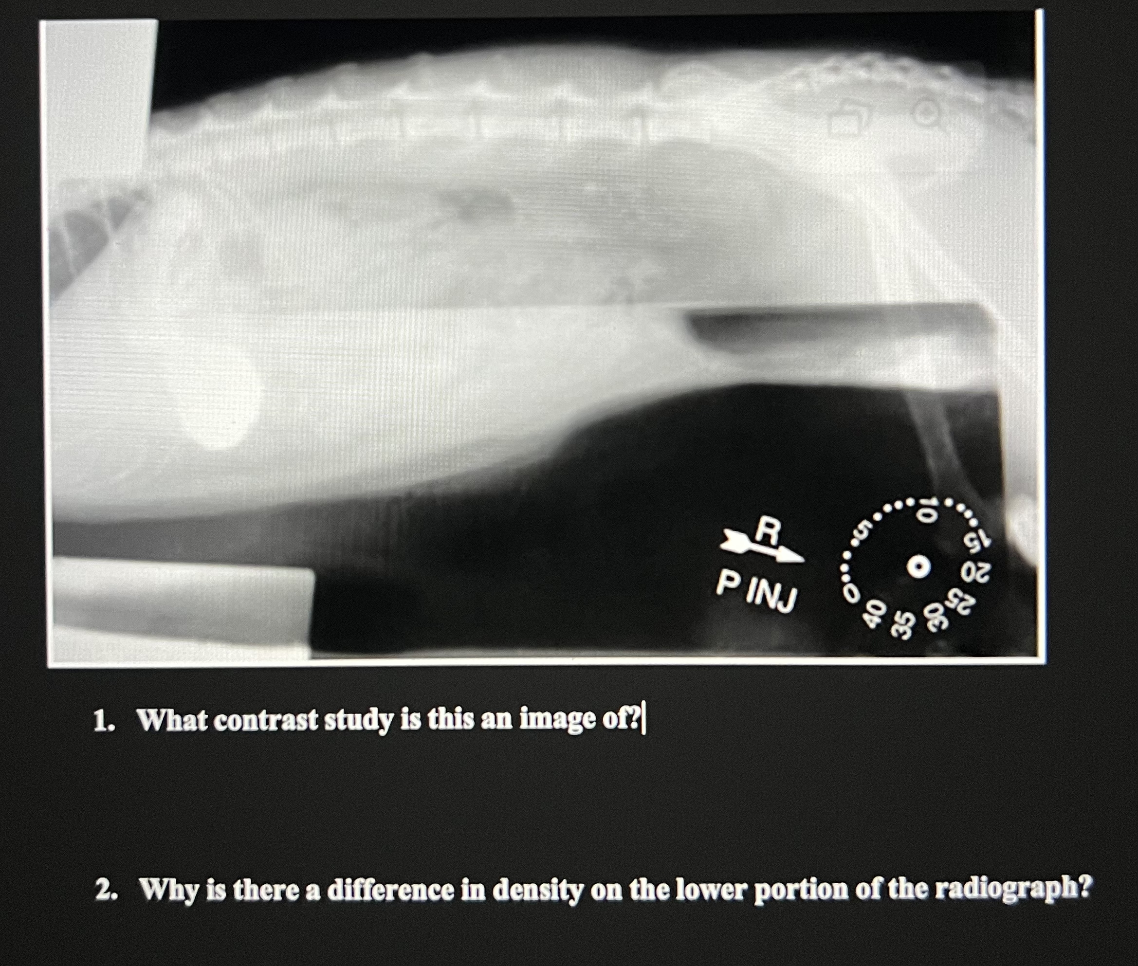 Solved What contrast study is this an image of:lWhy is there | Chegg.com