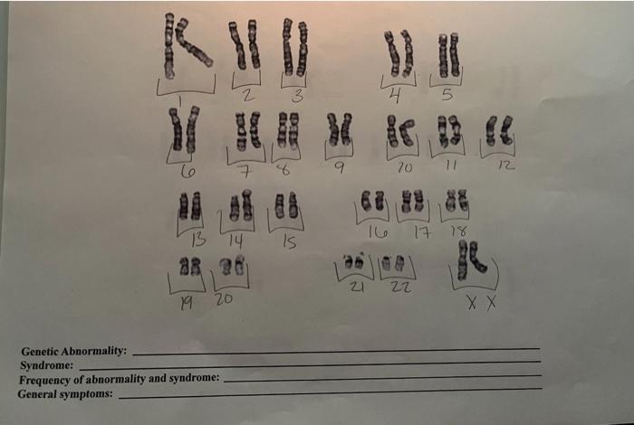 I need the missing information to this karyograph: | Chegg.com