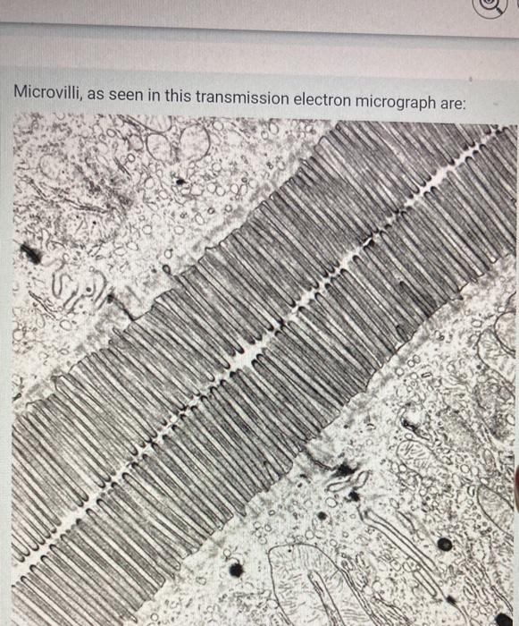 Solved Microvilli, as seen in this transmission electron | Chegg.com