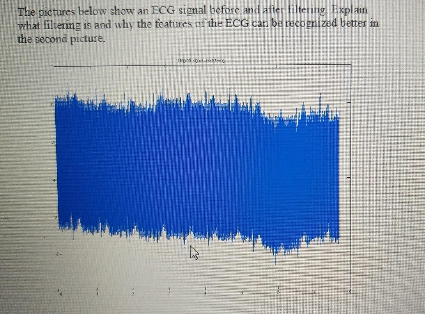 The pictures below show an ECG signal before and | Chegg.com