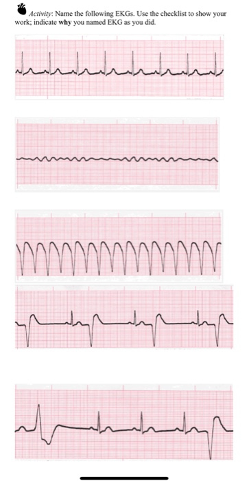 Solved Activity: Name the following EKGs. Use the checklist | Chegg.com