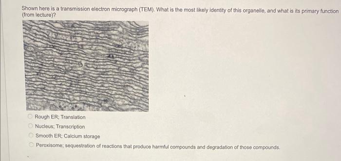 Solved Shown here is a transmission electron micrograph | Chegg.com