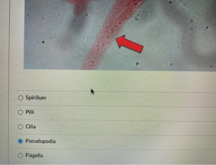 Solved What are the finger-like projections on this organism | Chegg.com