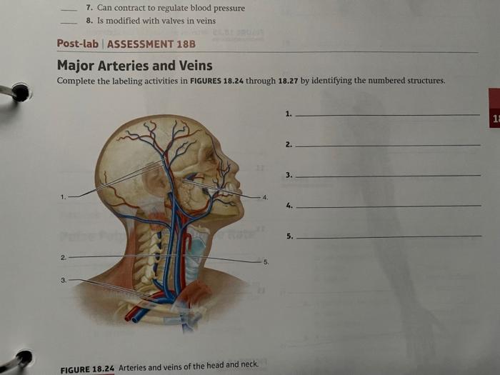 Solved Blood Vessel Anatomy Match the anatomical terms with | Chegg.com