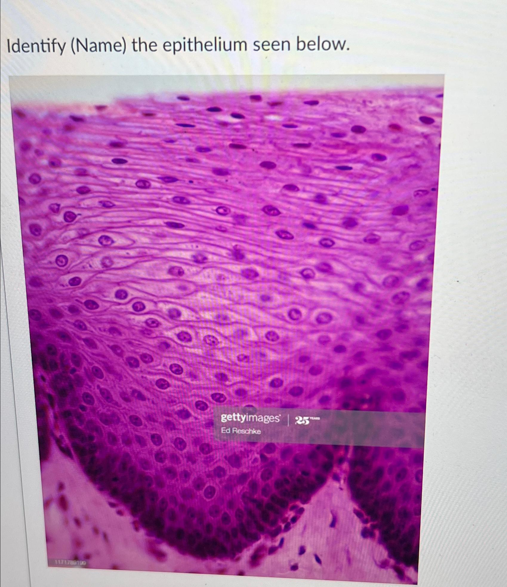 Solved Identify (Name) ﻿the epithelium seen below. | Chegg.com
