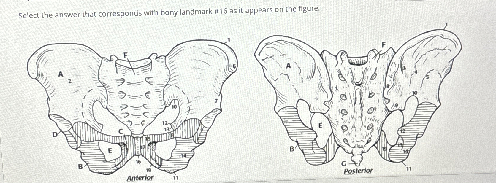 Solved Select the answer that corresponds with bony landmark | Chegg.com