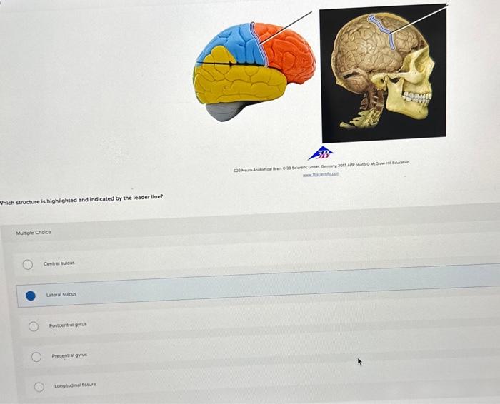 Solved Which structure is highlighted and indicated by the | Chegg.com